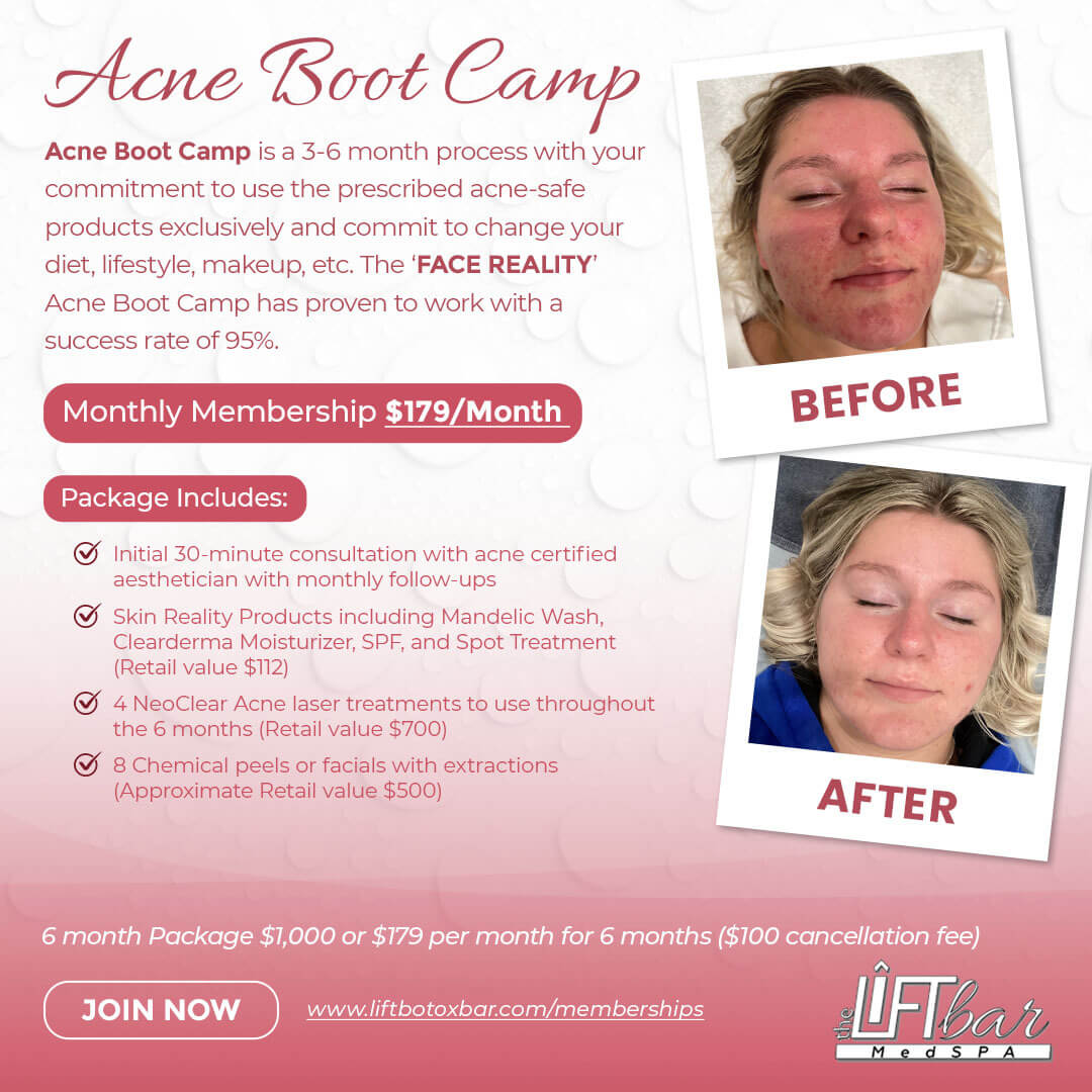 Clubs | The Lift Bar Med Spa